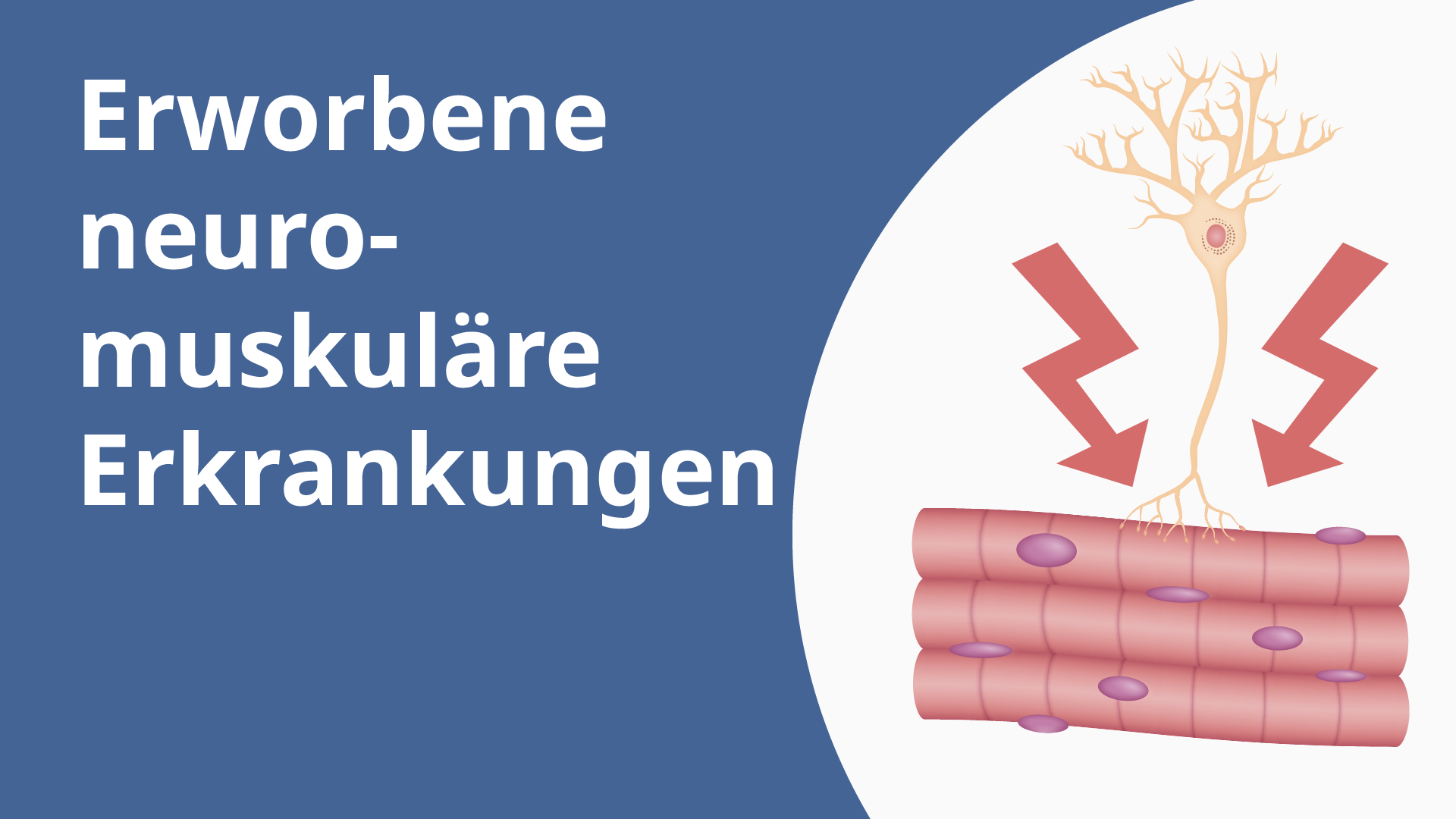 Erworbene neuromuskuläre Erkrankungen – Online Kurs | Lecturio