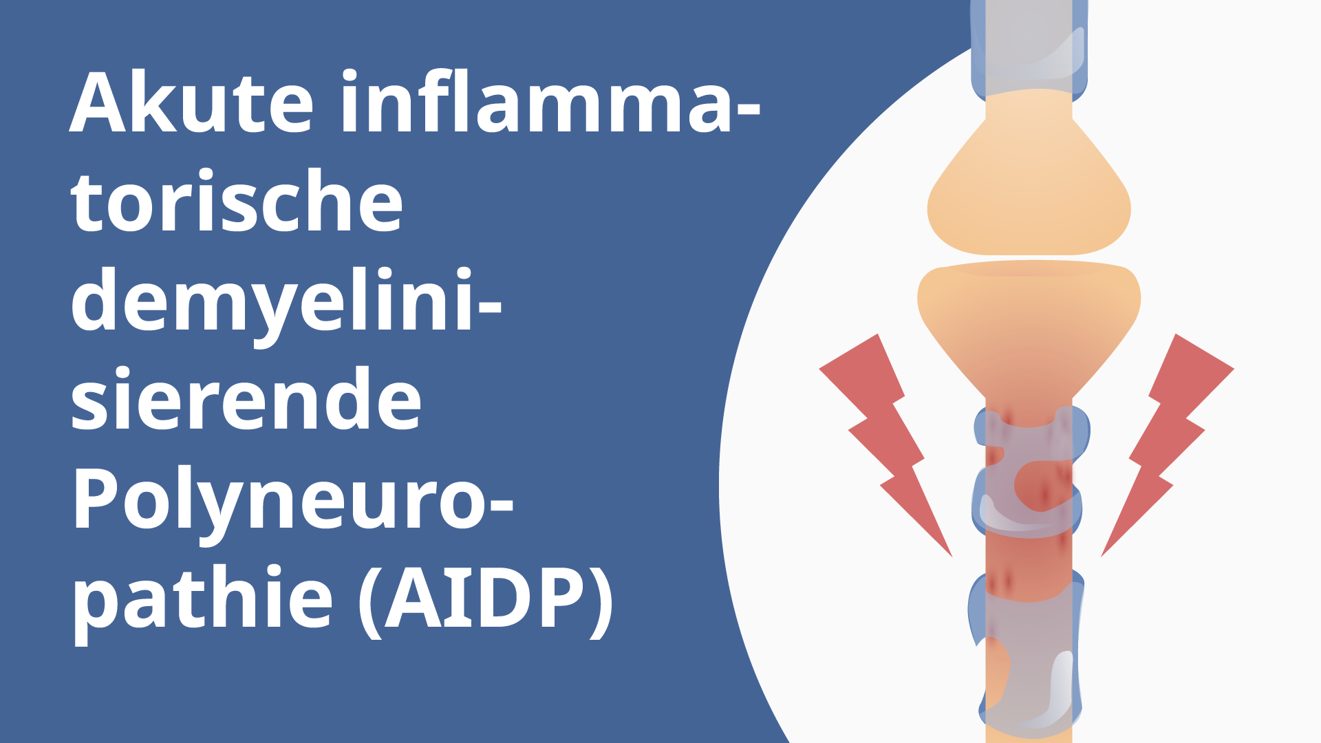 AIDP: Behandlung und Varianten – Online Vortrag | Lecturio