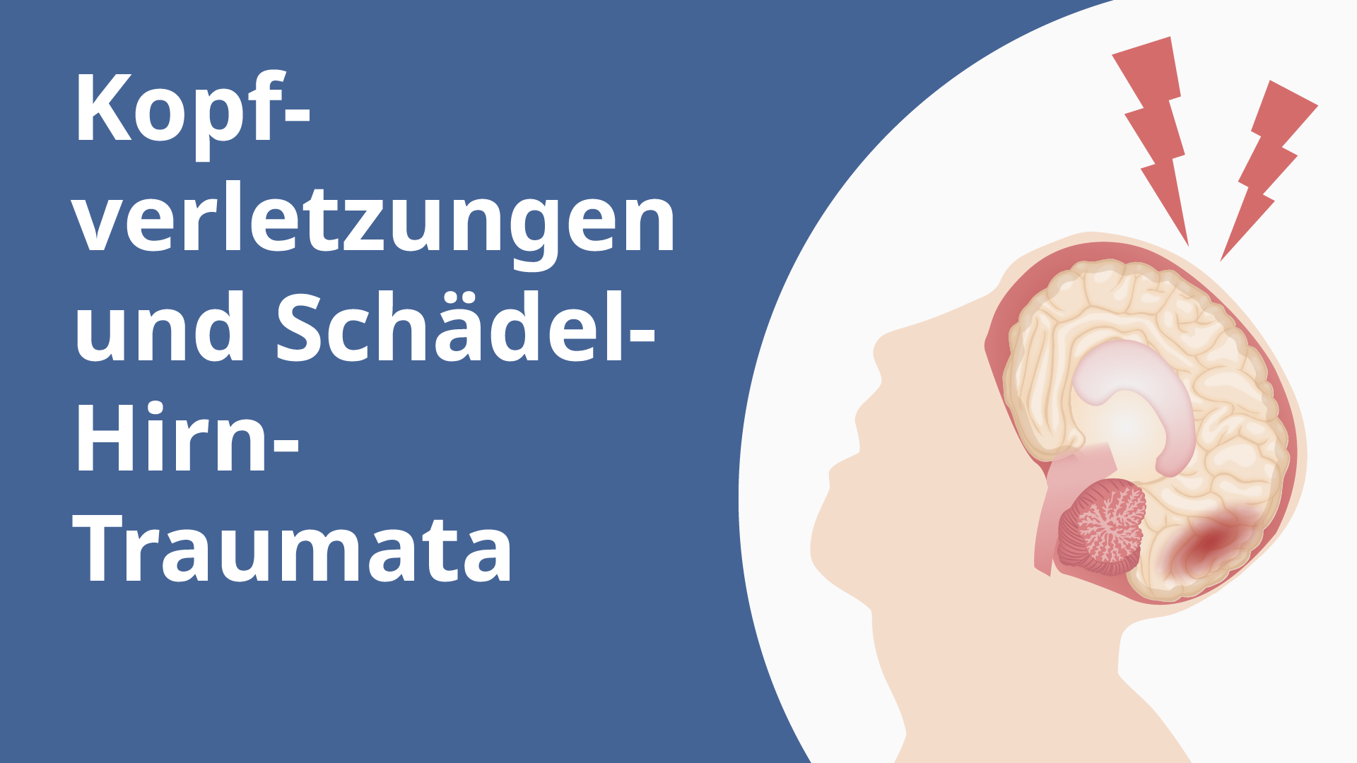 Schädel-Hirn-Trauma: Diagnose – Online Vortrag | Lecturio