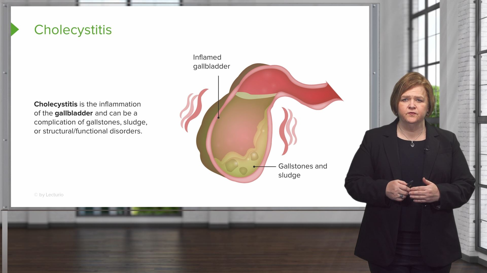 Gallstones & Cholecystitis: Introduction & Symptoms – Video